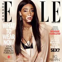 Elle Canada : Winnie Harlow